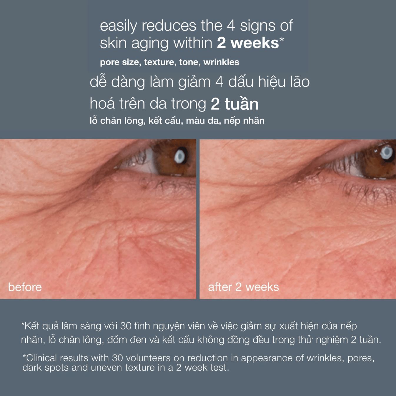 Dynamic Skin Retinol Serum 30ml [Apply DE2% get -2%] – Dermalogica Vietnam