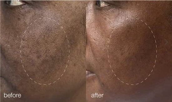 Hệ thống tái tạo Melano Pro – Dermalogica Vietnam